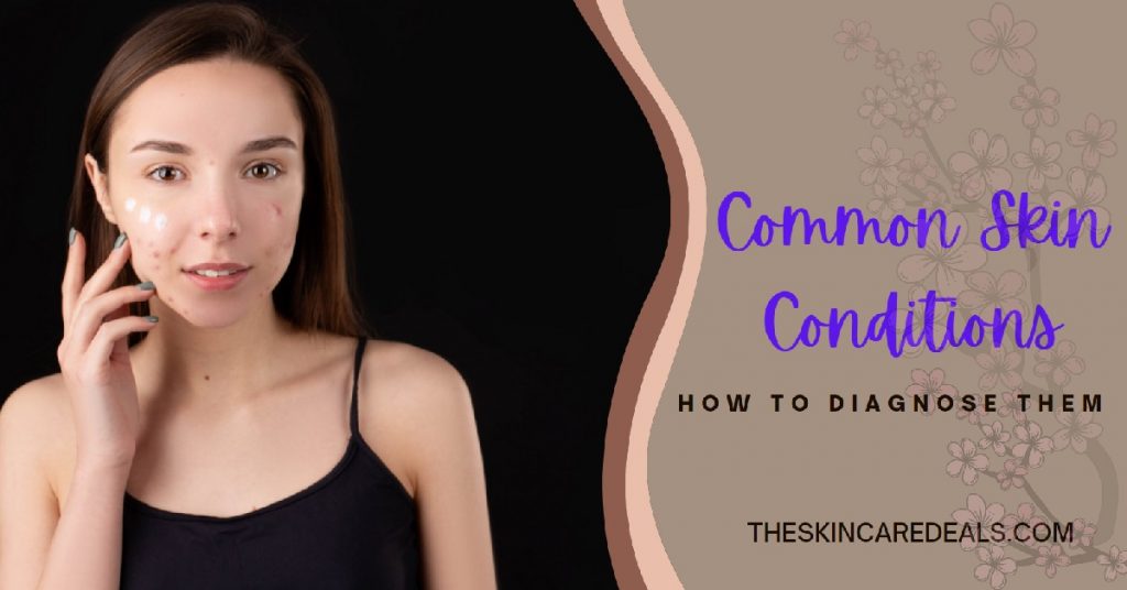 Common Skin Conditions & How to Diagnose Them - The Skin Care Deals