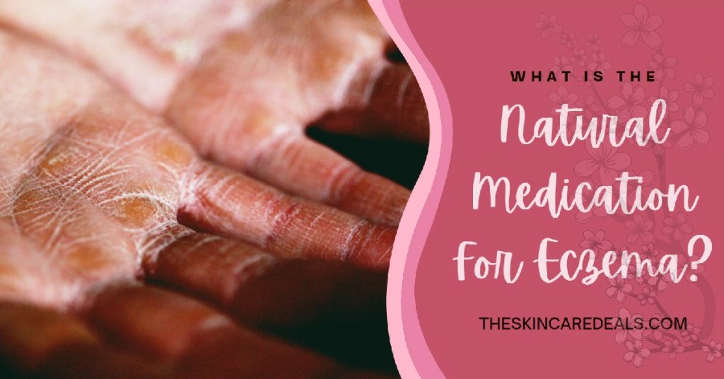 What is The Natural Medication For Eczema? - The Skin Care Deals